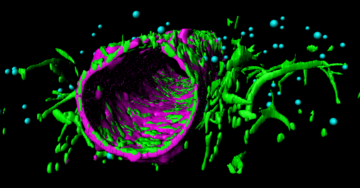 Lymphoma-on-chip model reveals that lymph node stromal cells promote ...