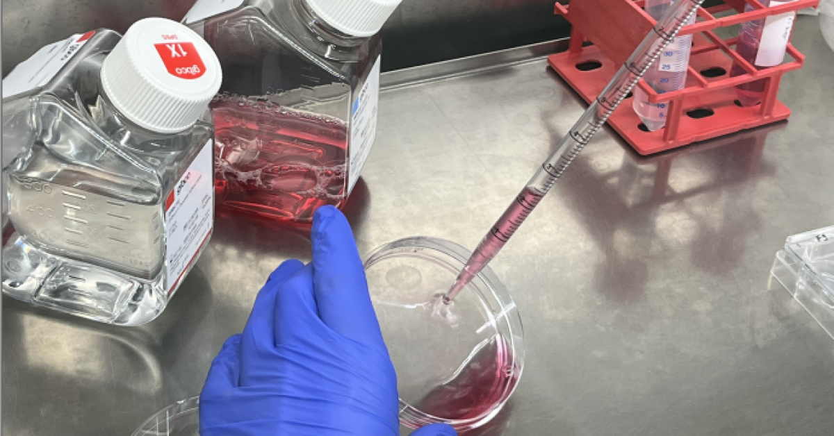 Generation of cell models | Amsterdam UMC