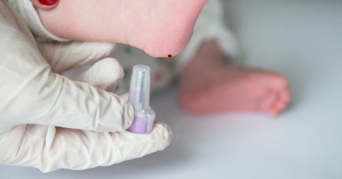 Metabolic disease adrenoleukodystrophy (ALD) now part of Dutch newborn ...