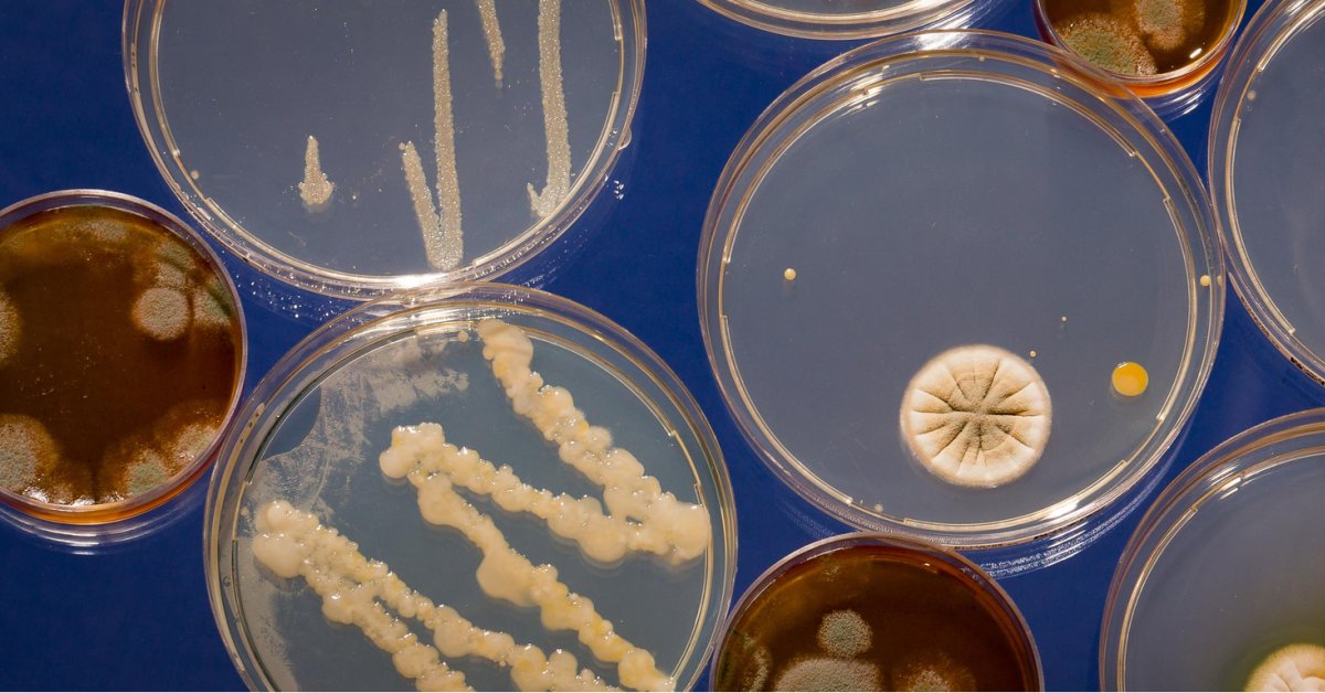 Artikelen over microbiologie | Amsterdam UMC