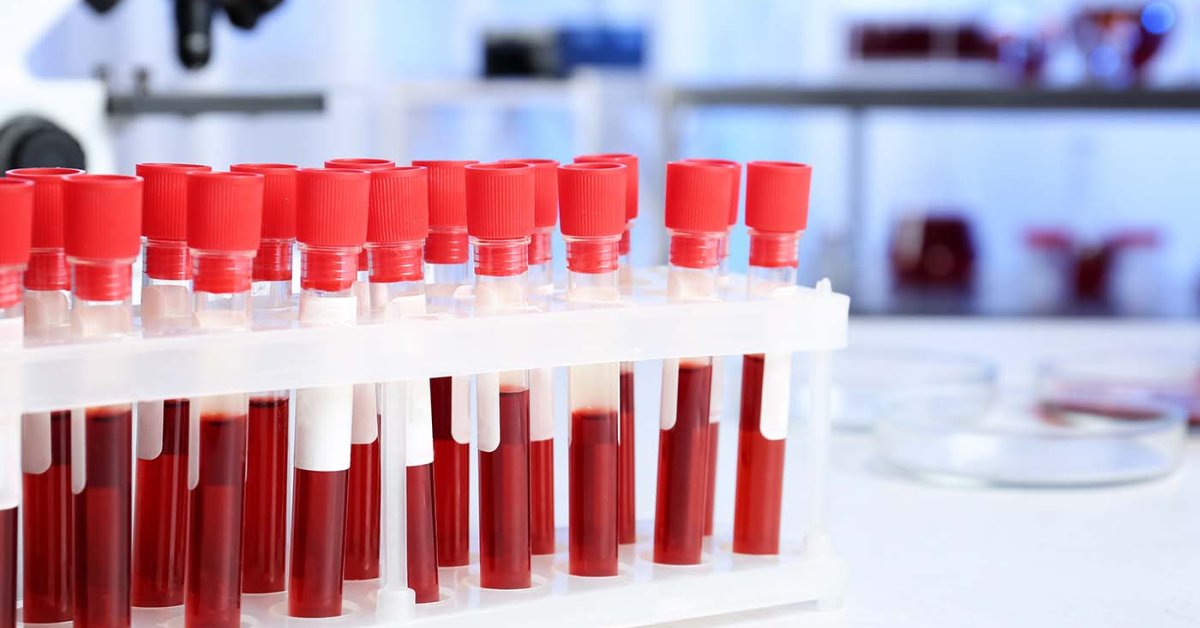 The Alzheimer’s Drug Discovery Foundation invests to accelerate ...