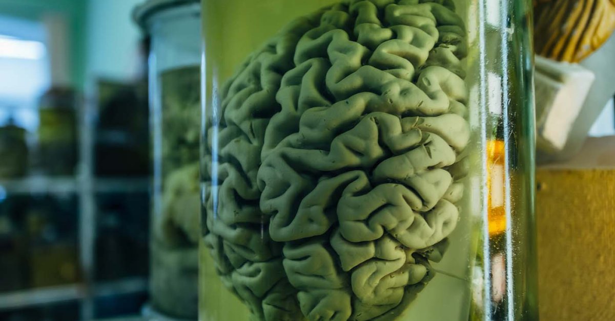 Post-mortem diagnostics of brain tissue is a threatened with extinction ...