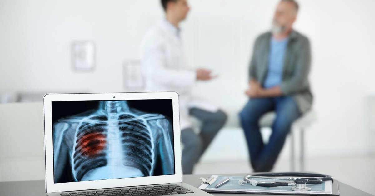 Improving detection of recurrences during follow-up care in lung cancer ...