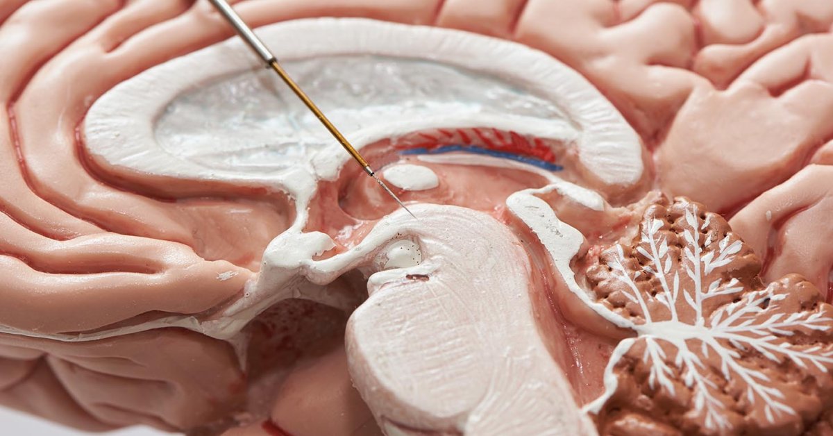 Negative mood and anxiety can be modulated by deep brain stimulation ...