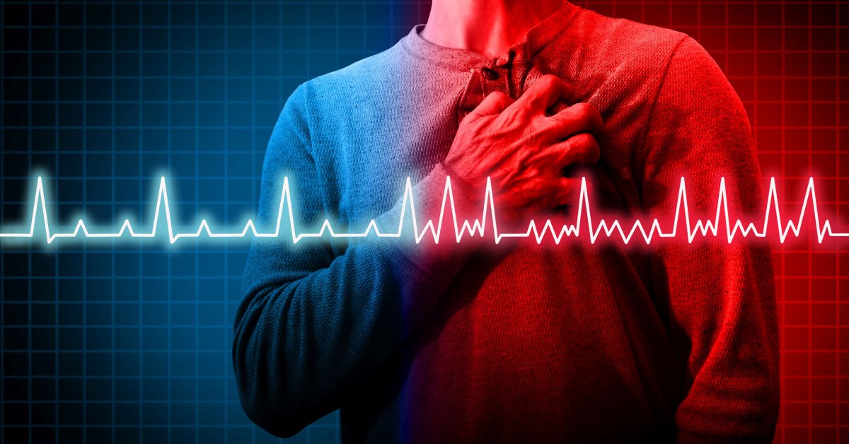 Using radiotherapy to treat cardiac arrhythmia | Amsterdam UMC