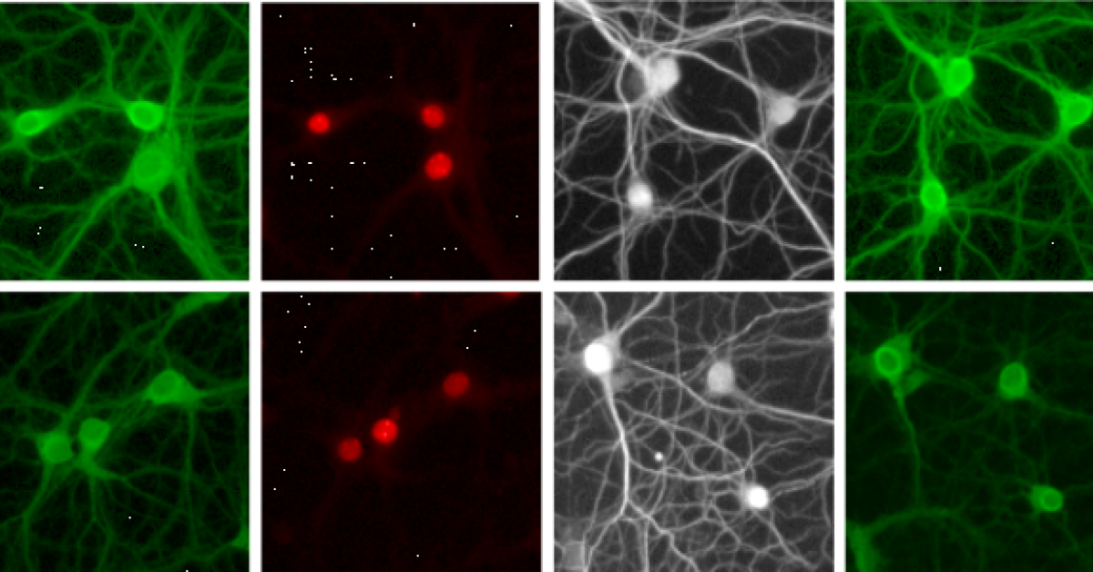 Novel insights into neuronal resilience to proteostatic stress ... Novel insights into neuronal resilience to proteostatic stress ...